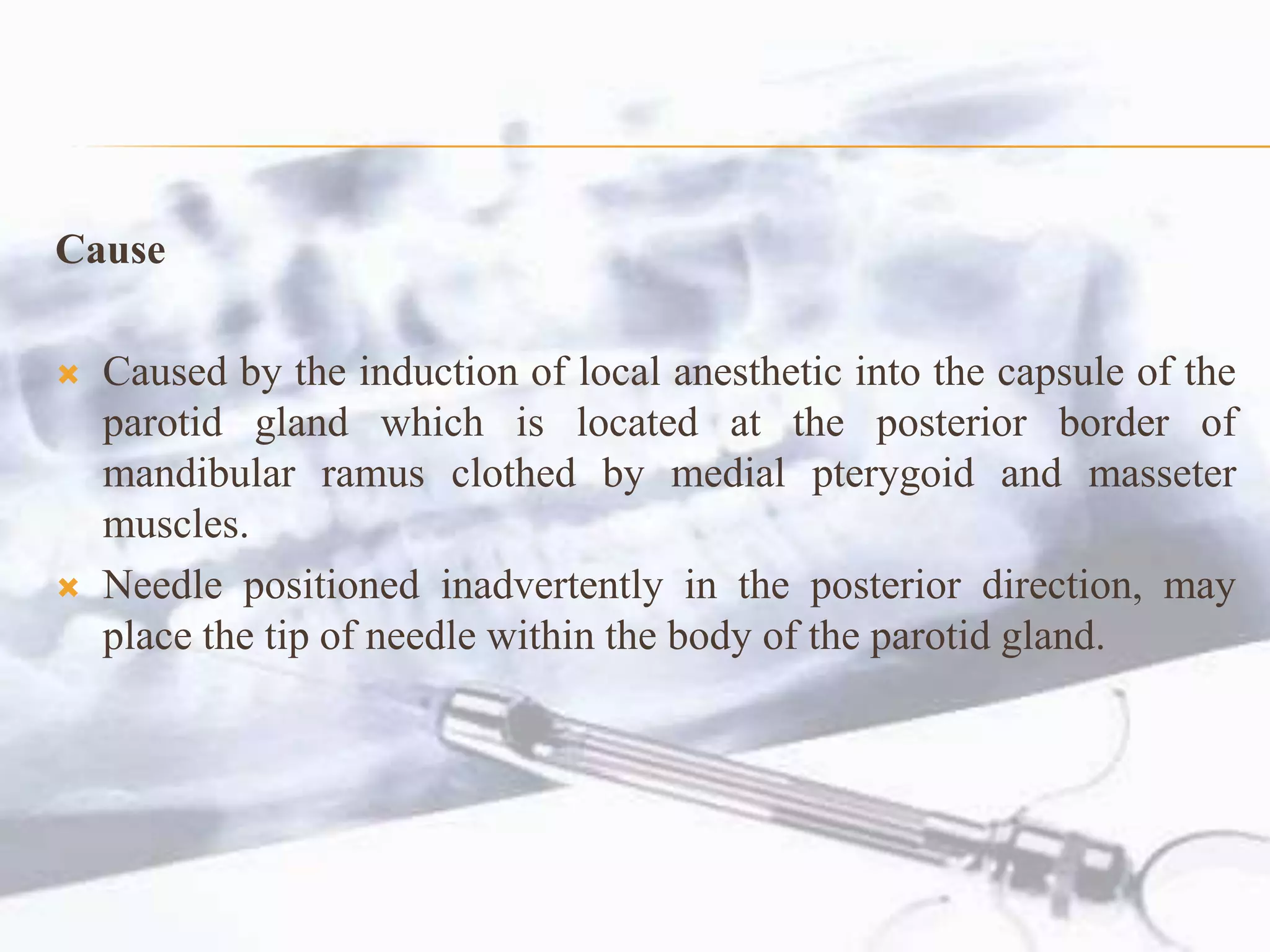 Complications of local anaesthesia | PPTX
