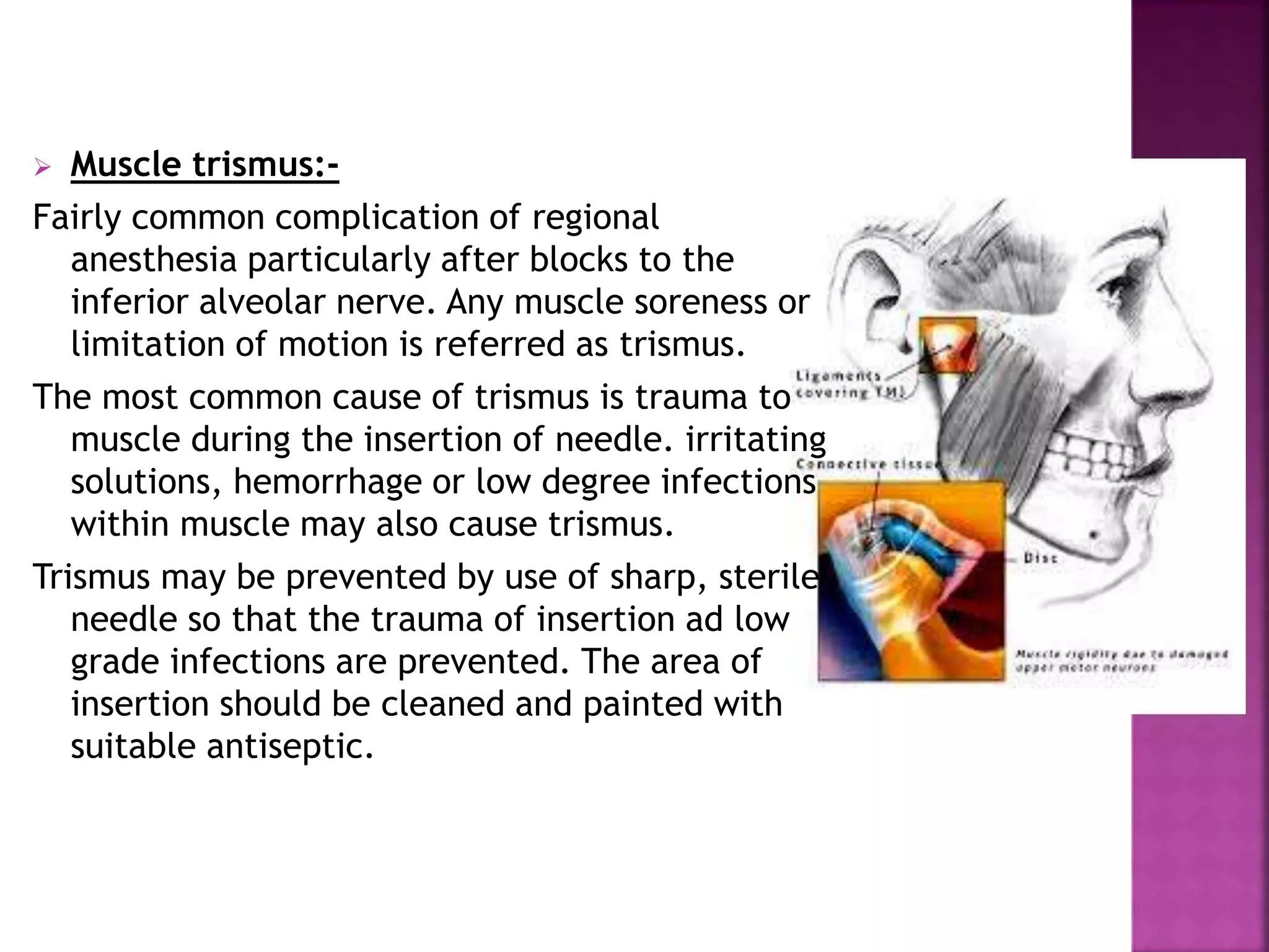 Complications of local anesthesia | PPTX