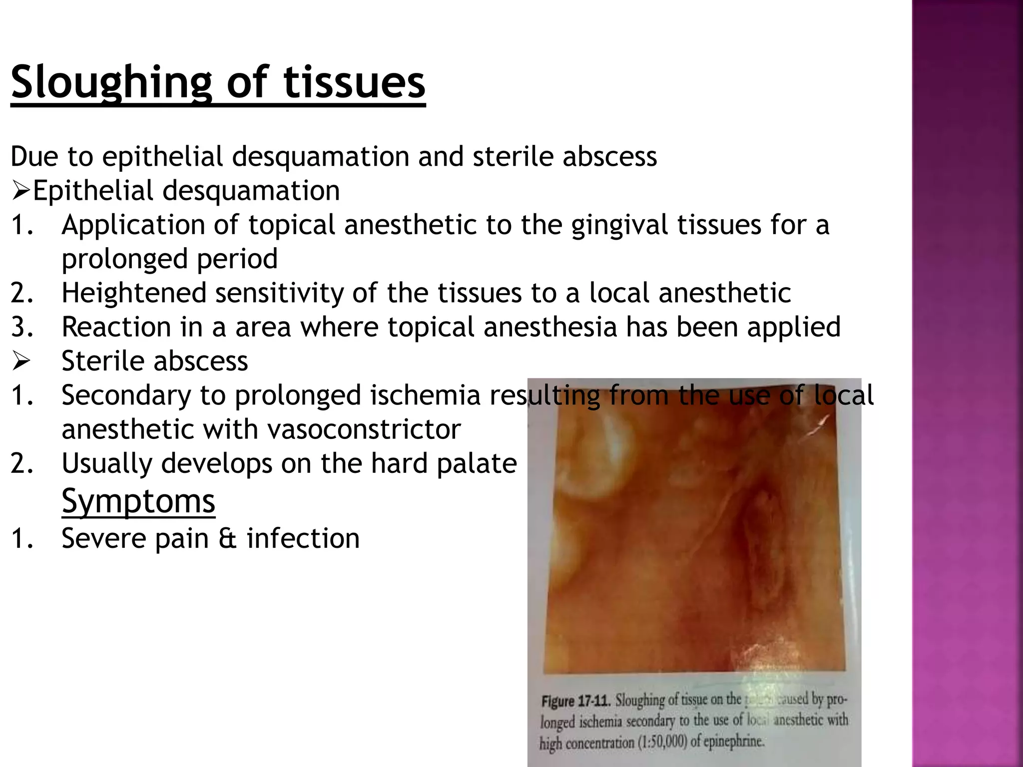 Complications of local anesthesia | PPTX