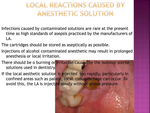 Complications of local anesthesia | PPTX