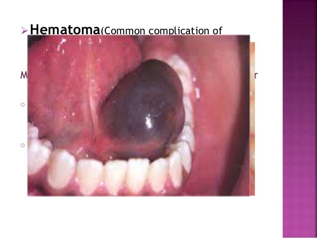 Complications of local anesthesia