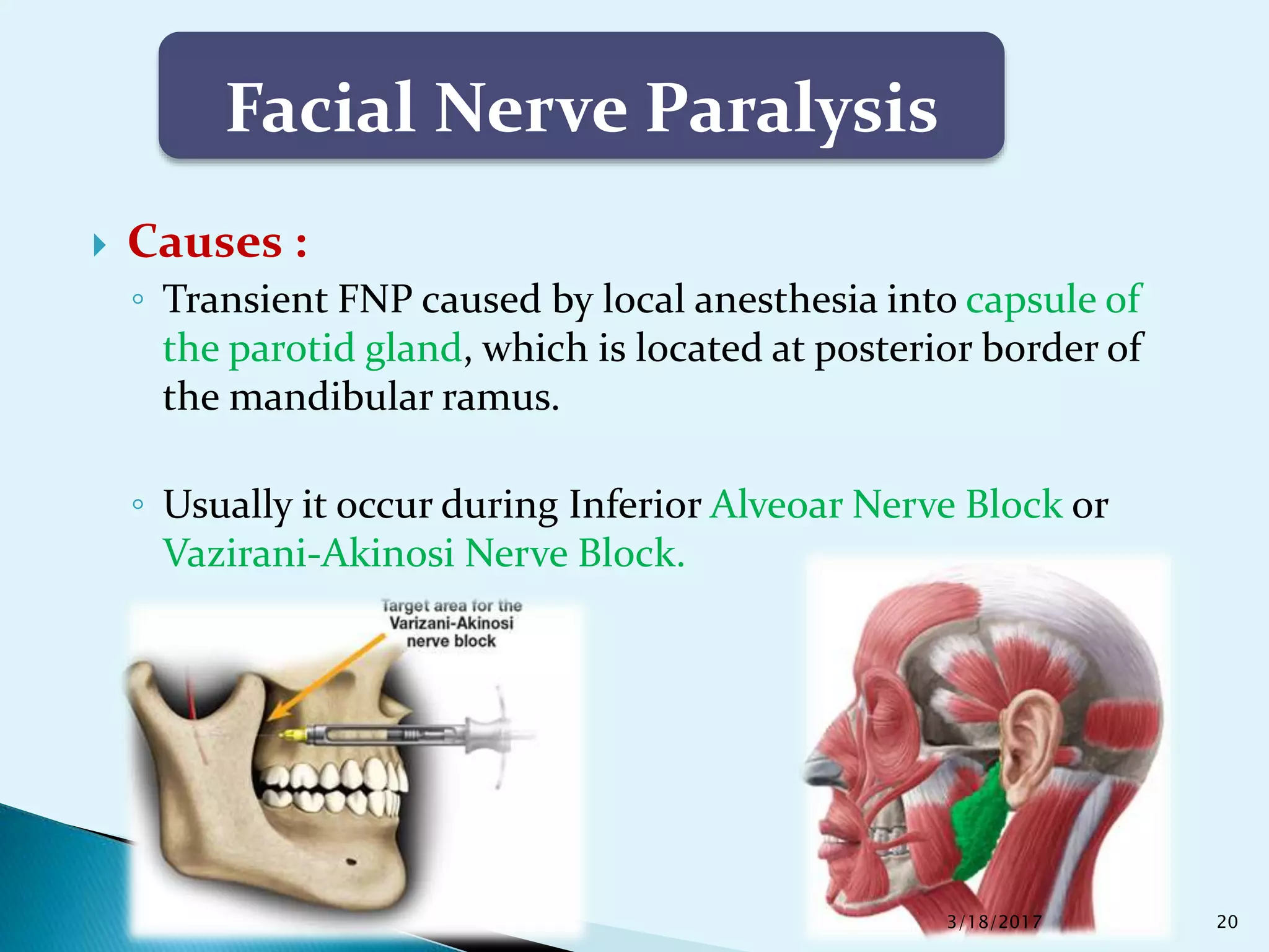 Complications of Local Anesthesia | PPTX