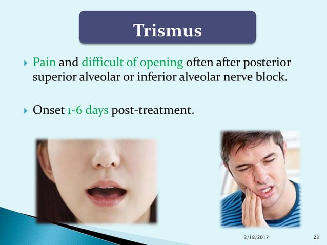 Complications of Local Anesthesia | PPTX | First Aid | Injuries