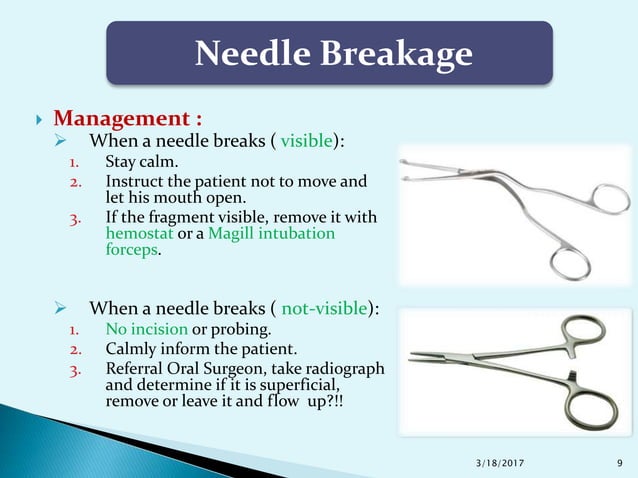 Complications of Local Anesthesia | PPTX | First Aid | Injuries