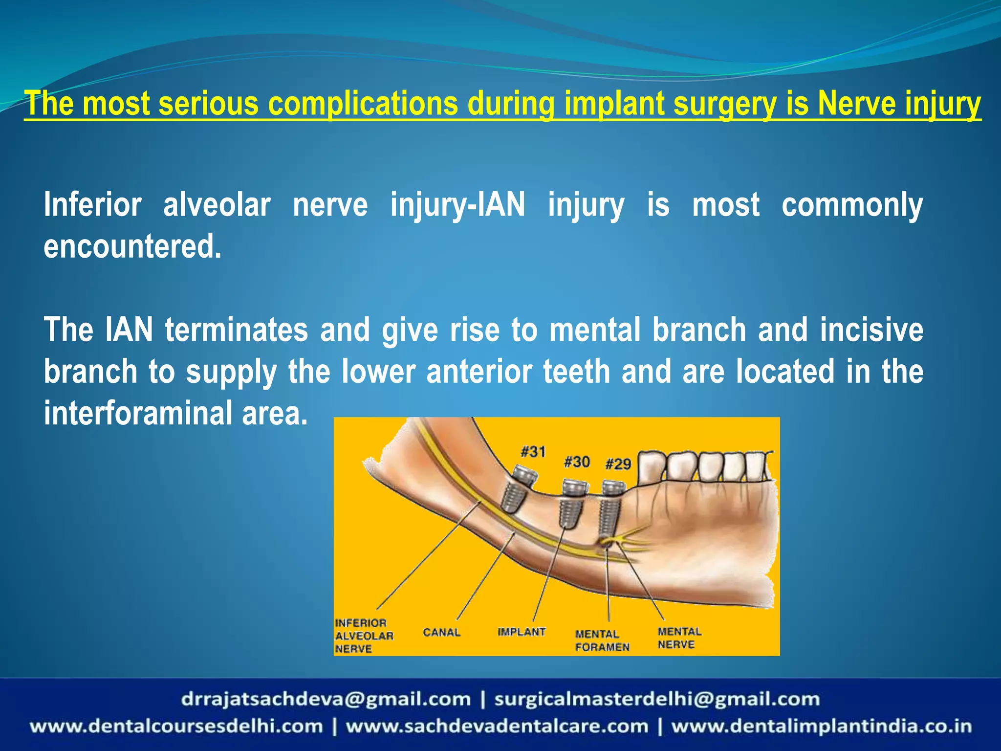 Complications of lower anterior implants| Complications of Dental ...