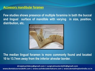 Complications of lower anterior implants| Complications of Dental ...