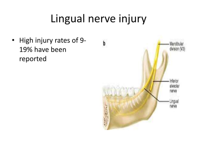 Complications of mandibular orthognathic surgery | PPTX | First Aid ...