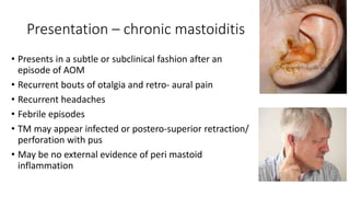Complications of mastoiditis | PPTX