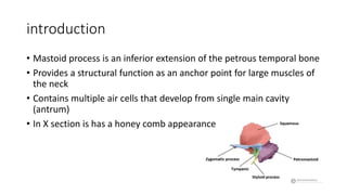 Complications of mastoiditis | PPTX | Ear, Nose and Throat Conditions ...