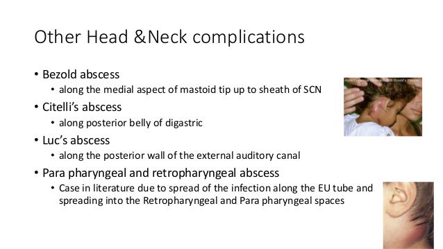 Complications of mastoiditis