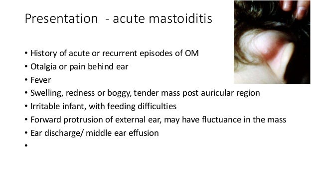 Complications of mastoiditis