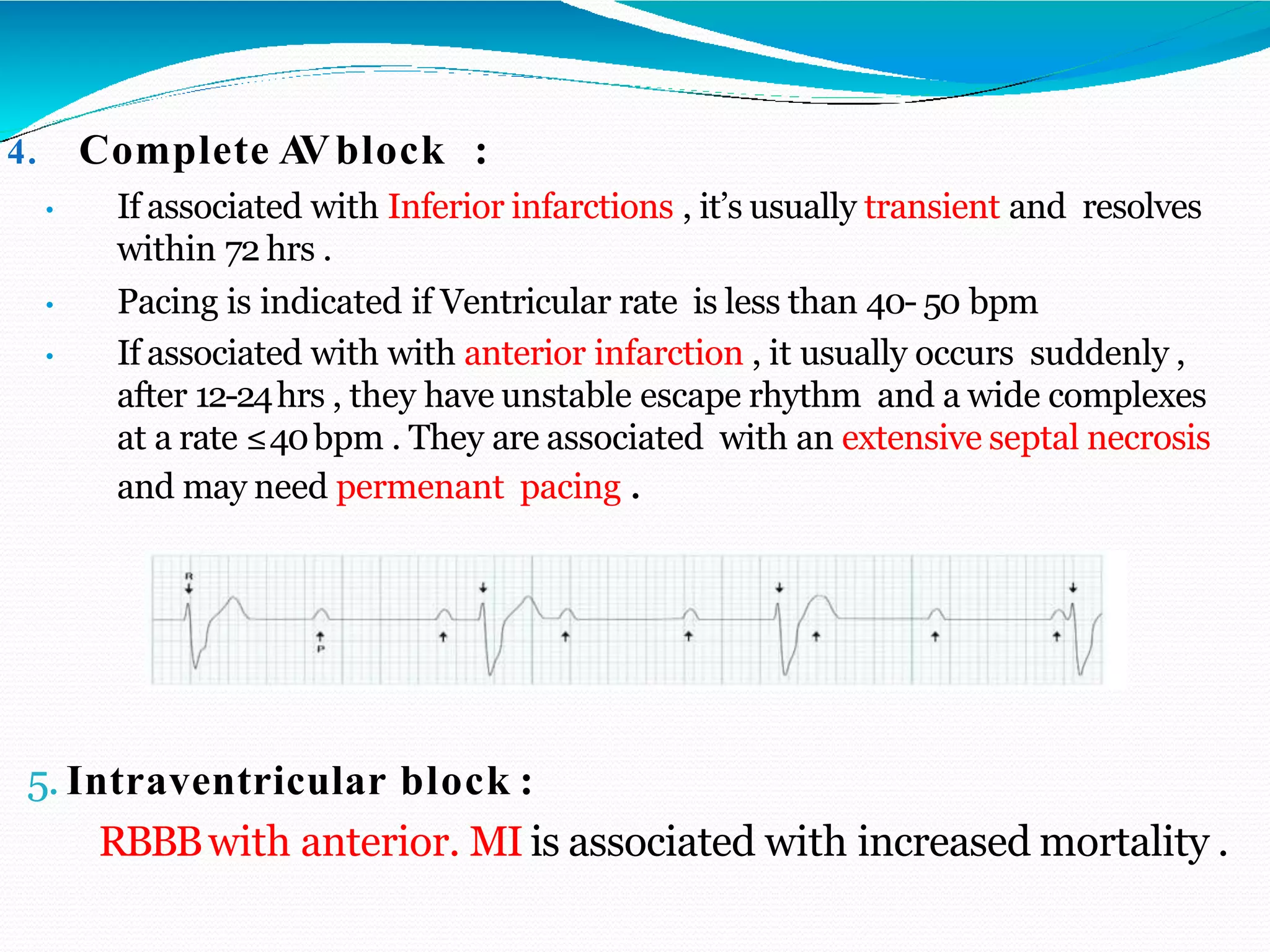 Complications of MI and their managements | PPTX