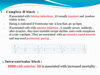 Complications of MI and their managements | PPTX