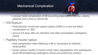 Complications of MI.pptx