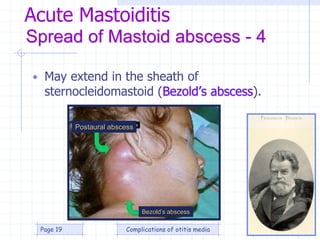 Complications of otitis media | PPT