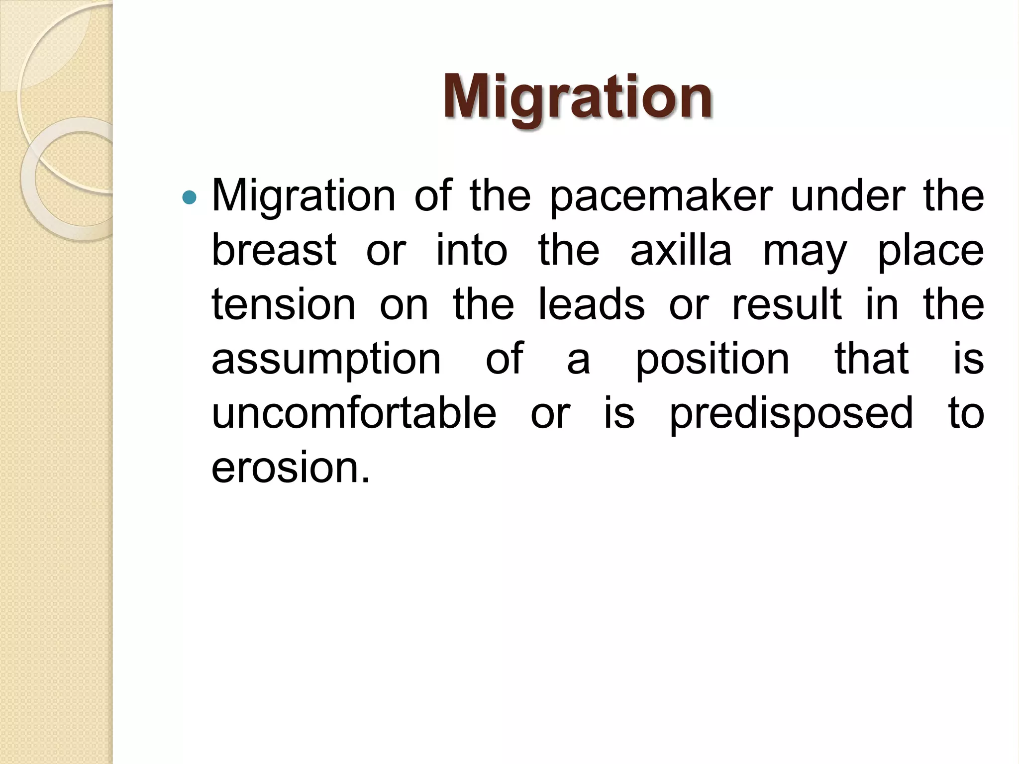 Complications of pacemaker implantation. Waleed Roshdy | PPTX