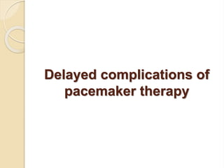 Complications of pacemaker implantation. Waleed Roshdy | PPTX
