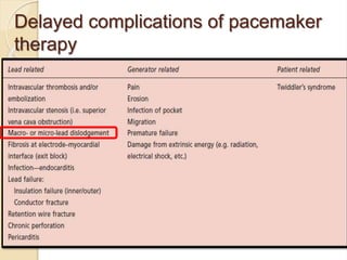 Complications of pacemaker implantation. Waleed Roshdy | PPTX