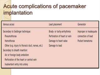 Complications of pacemaker implantation. Waleed Roshdy | PPTX