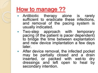 Complications of pacemaker implantation. Waleed Roshdy | PPTX