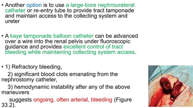 COMPLICATIONS OF PCNL.pptx | First Aid | Injuries