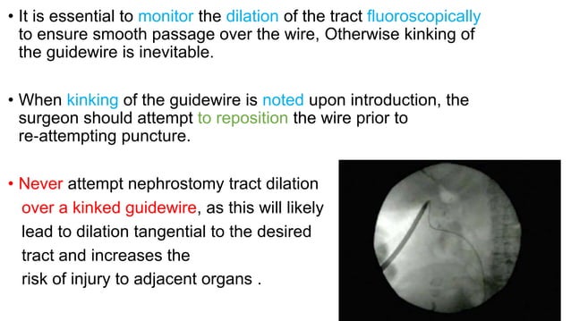 COMPLICATIONS OF PCNL.pptx | First Aid | Injuries