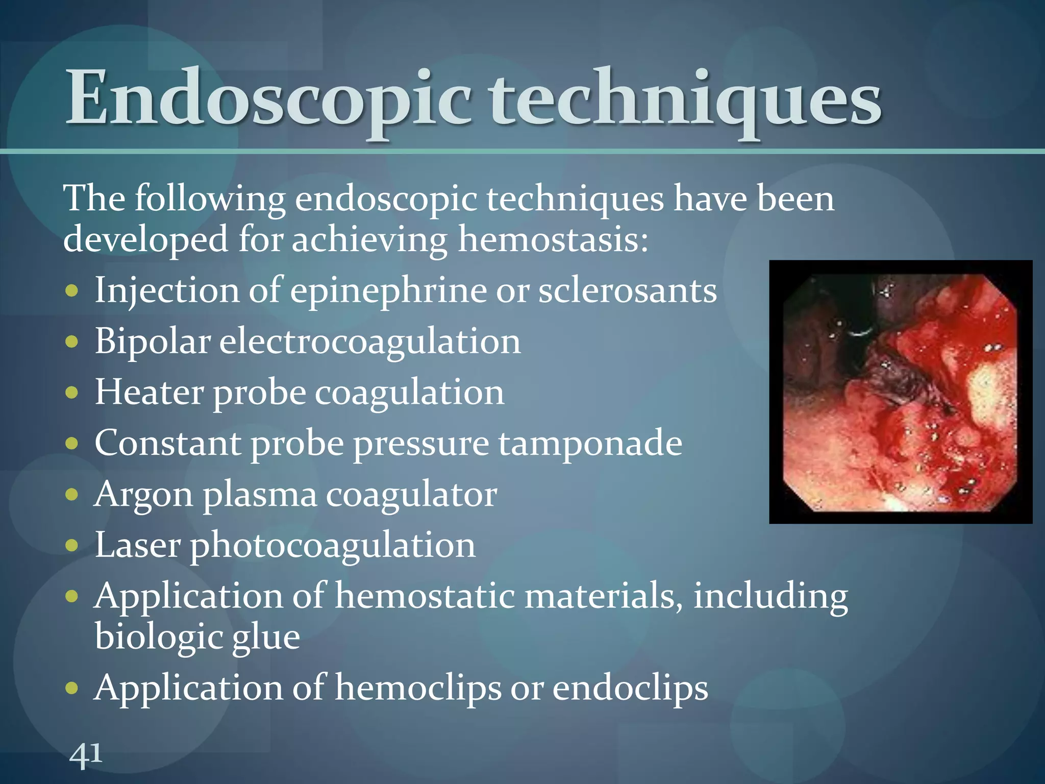 Complications of peptic ulcer | PDF