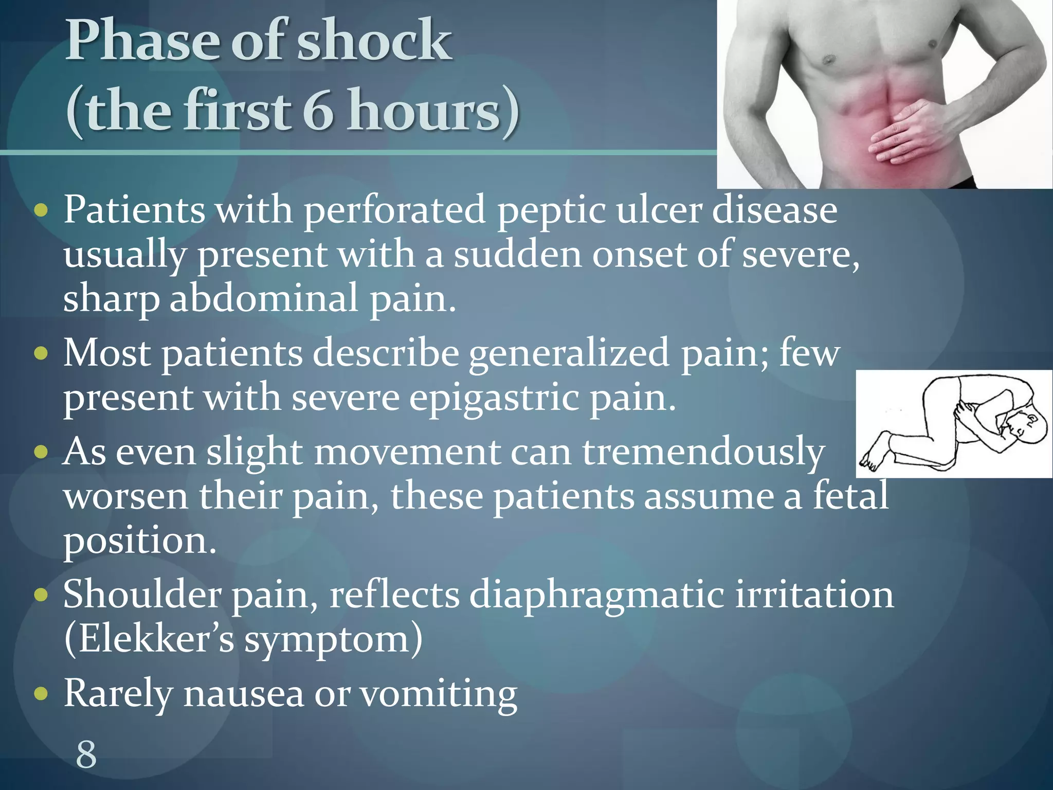 Complications of peptic ulcer | PDF