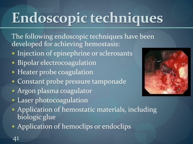 Complications of peptic ulcer | PDF | Digestive Disorders | Diseases ...