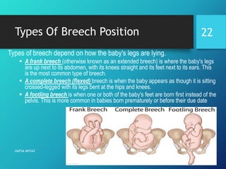Complications of pregnancy | PPTX