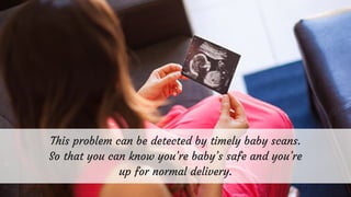 Complications of Preterm Birth | PDF