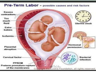 Complications of pre term labour | PPTX