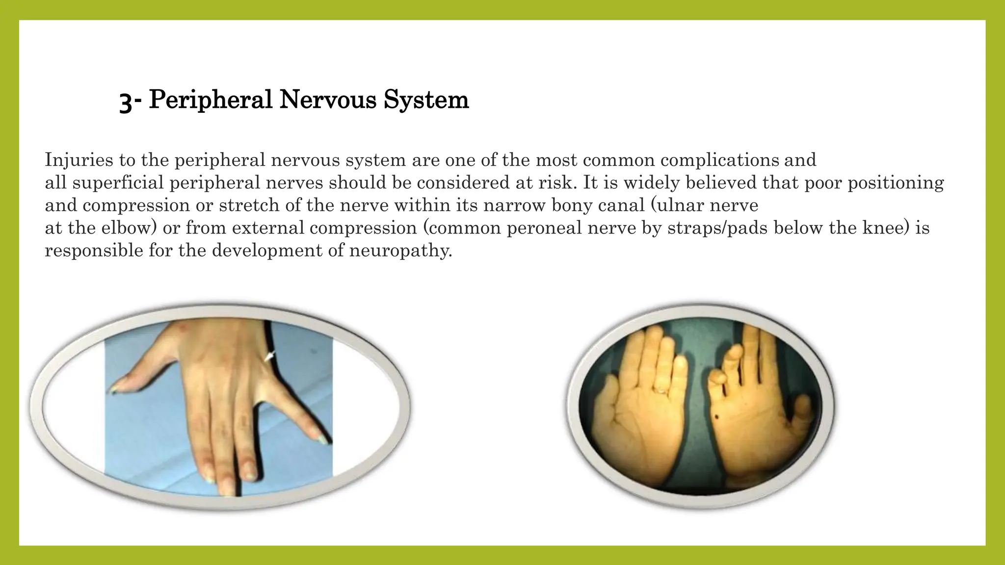 Complications of Prone Position For Anesthetized Patient - Copy.pptx