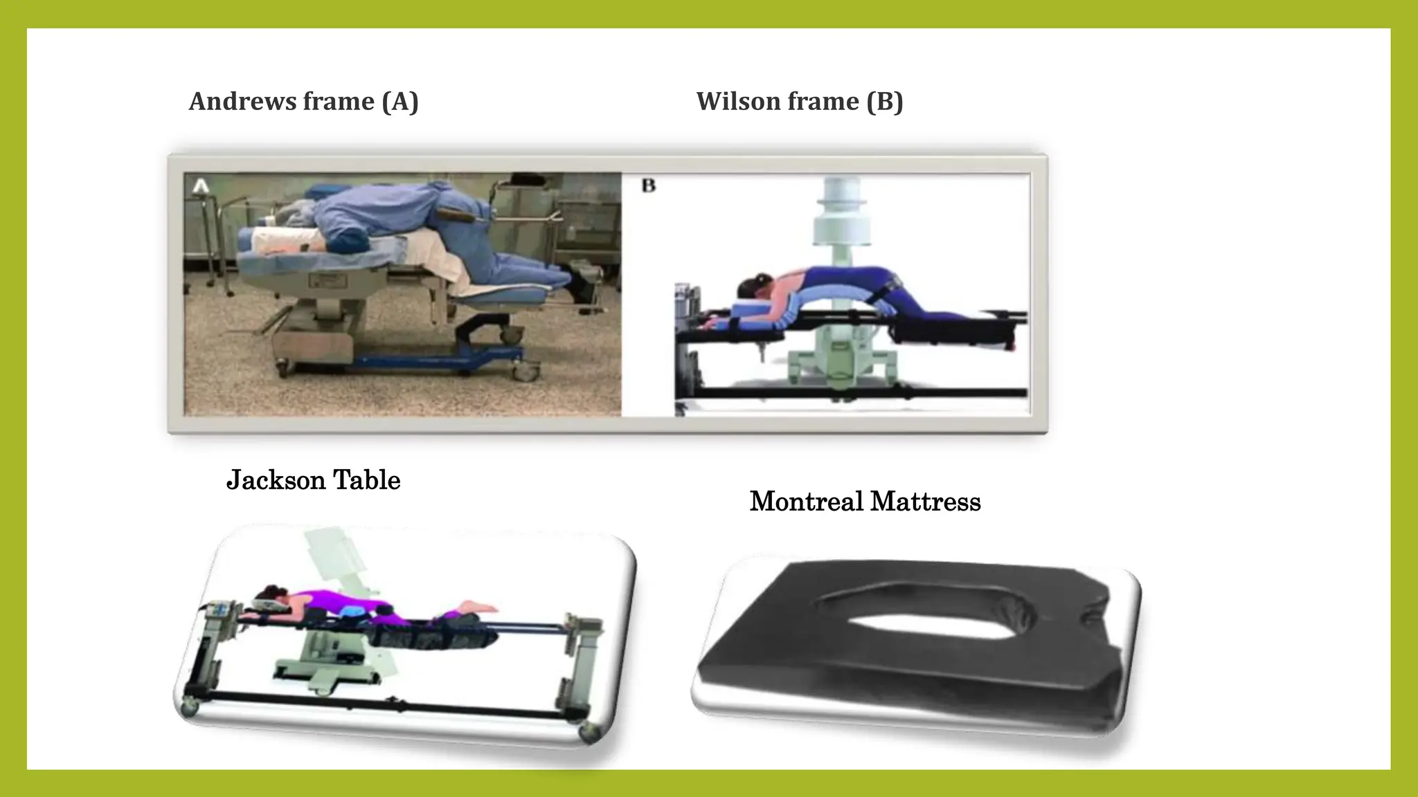Complications of Prone Position For Anesthetized Patient - Copy.pptx