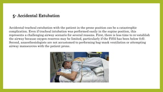 Complications of Prone Position For Anesthetized Patient - Copy.pptx