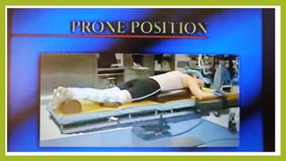 Complications of Prone Position For Anesthetized Patient - Copy.pptx