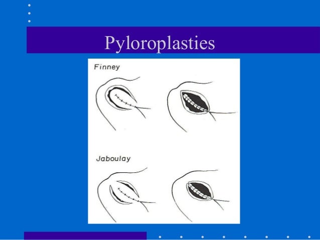 Complications of pud