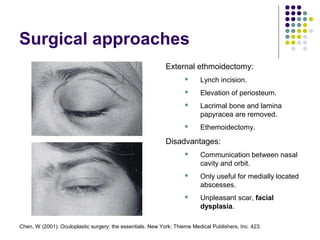Complications of rhinosonusitis | PPT