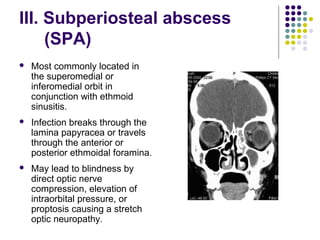 Subperiosteal Abscess