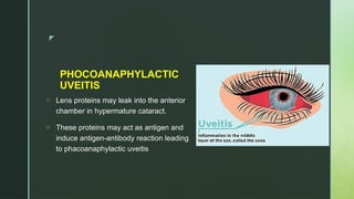 Complications of senile cataract .pptx