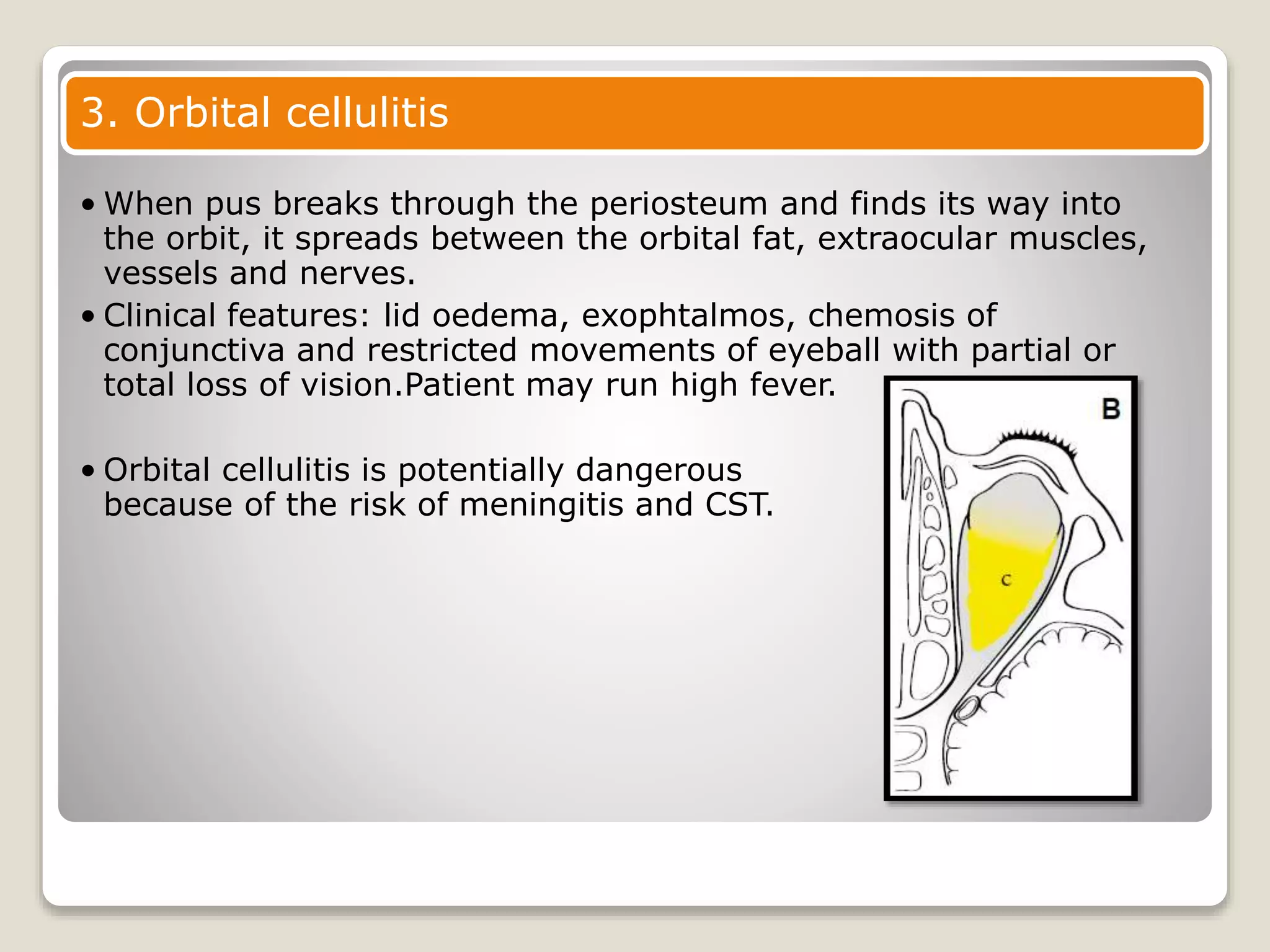 Complications of sinusitis | PPTX