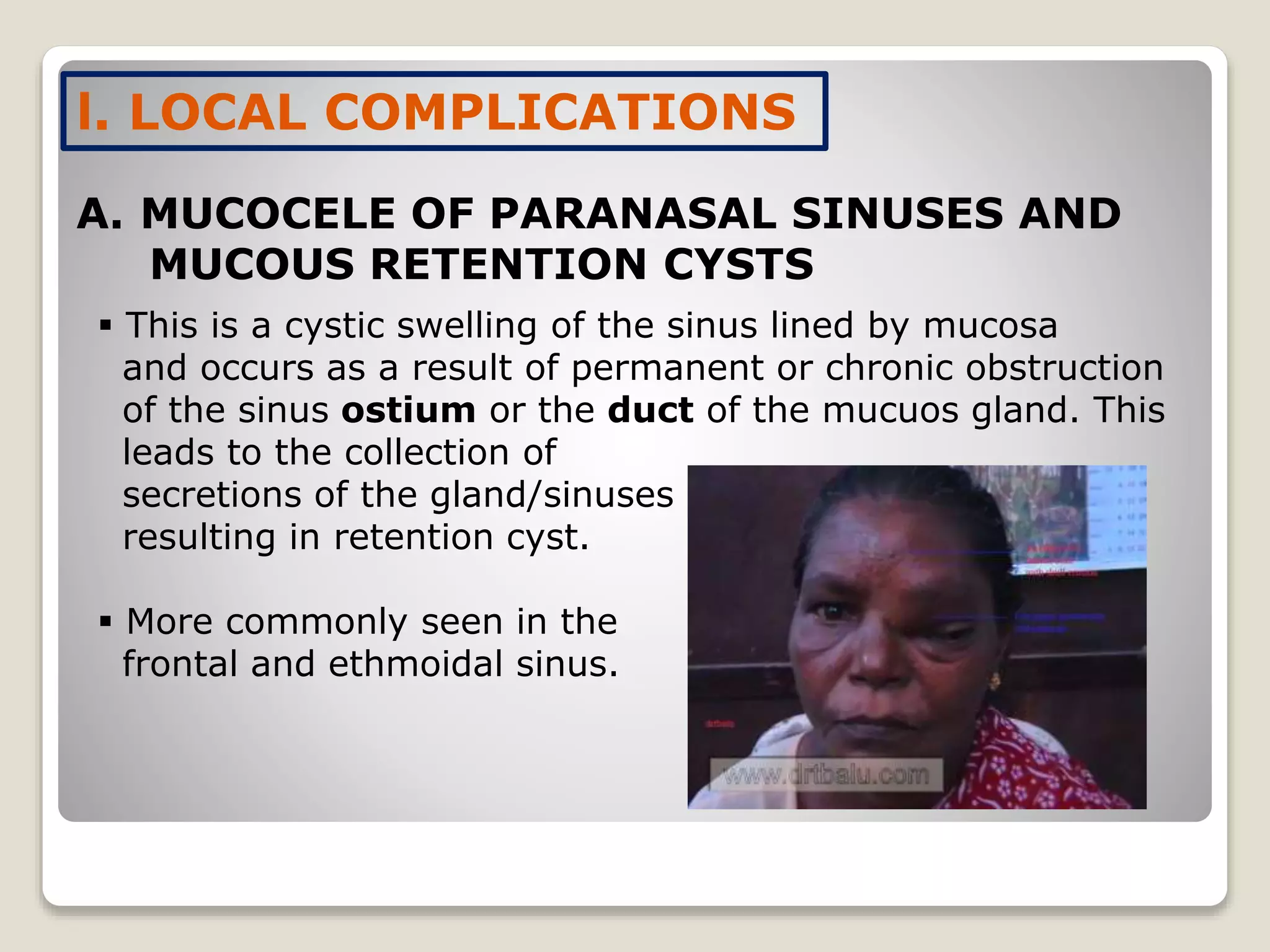 Complications of sinusitis | PPTX