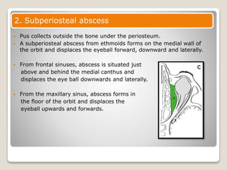 Complications of sinusitis | PPTX | Ear, Nose and Throat Conditions ...