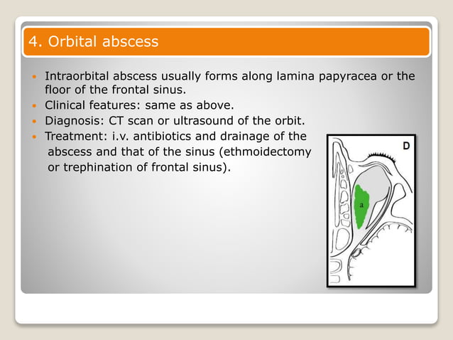 Complications of sinusitis | PPTX | Ear, Nose and Throat Conditions ...