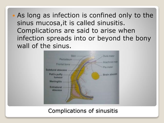 Complications of sinusitis | PPTX | Ear, Nose and Throat Conditions ...