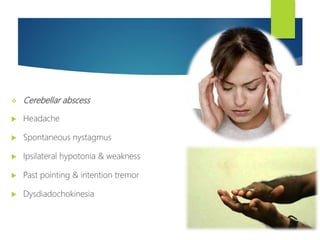 Complications of som | PPTX