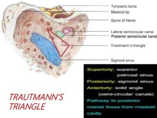 Complications of som | PPT