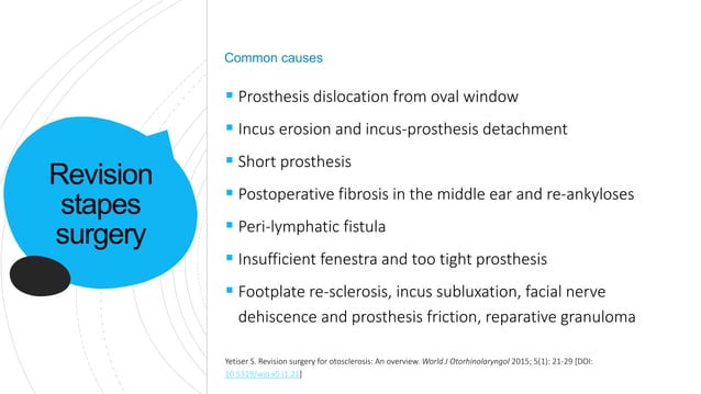 Complications of Stapes surgery.pptx | Ear, Nose and Throat Conditions ...