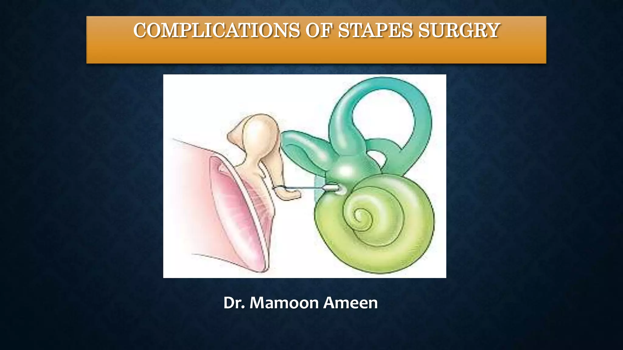 Complications of stapes surgry | PPTX