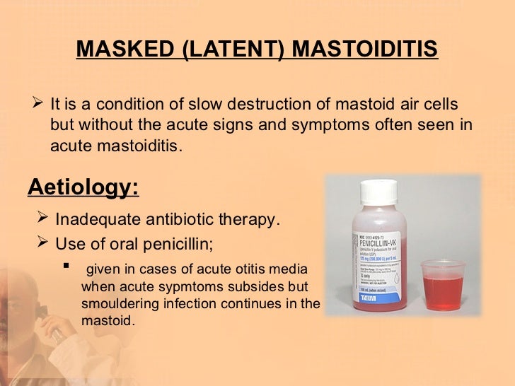 Mastoiditis In Adults Treatment Mastoid Surgery | Augusta Aiken ENT